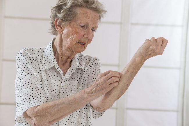 Shingles: Causes, Symptoms and Treatment | Live Science