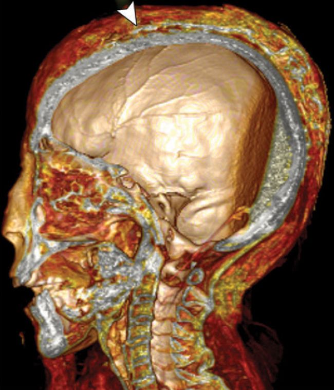 Image Gallery: The Faces of Egyptian Mummies Revealed | Live Science