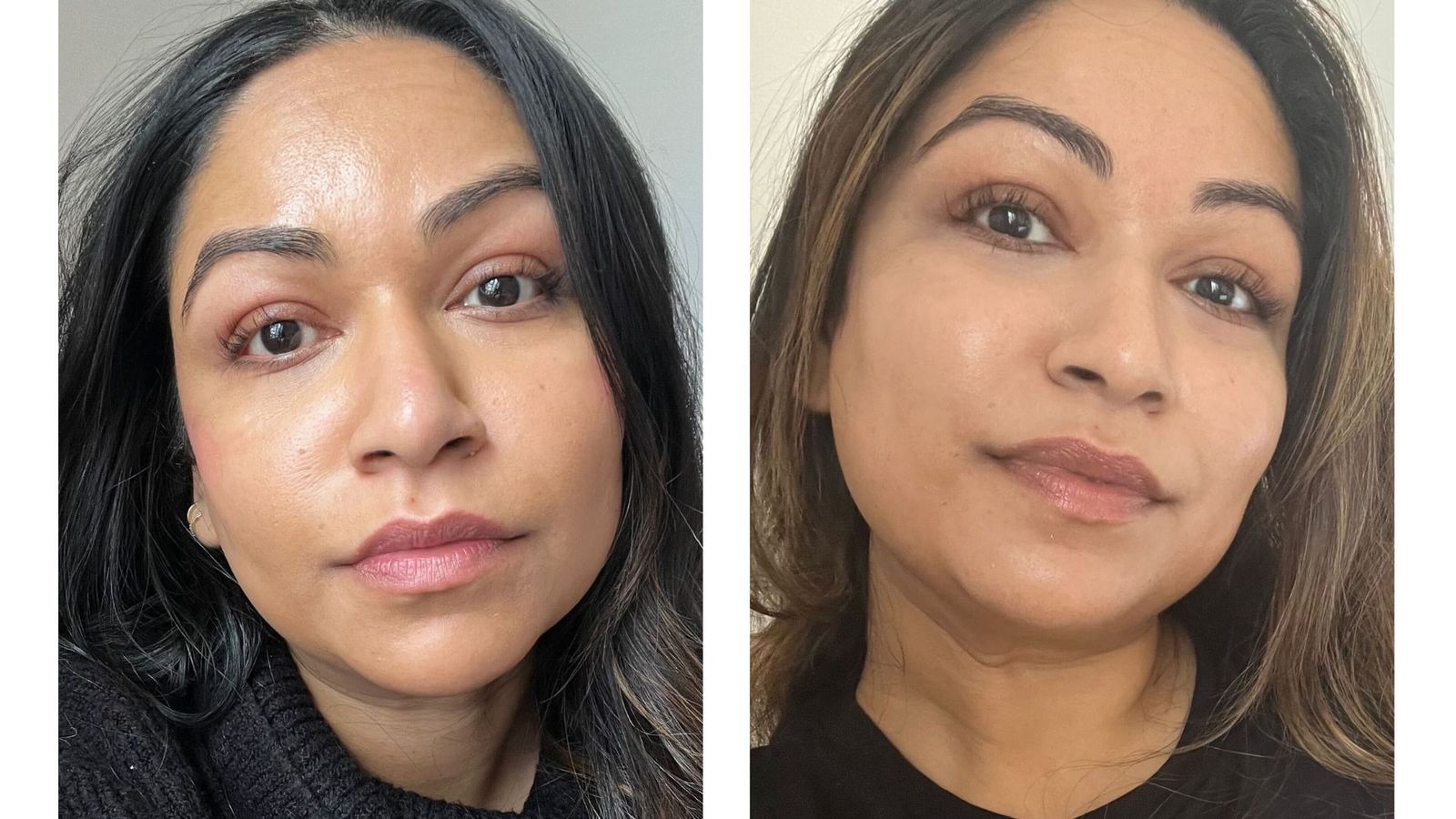 This is the only serum that gives me full lashes without a bad reaction ...