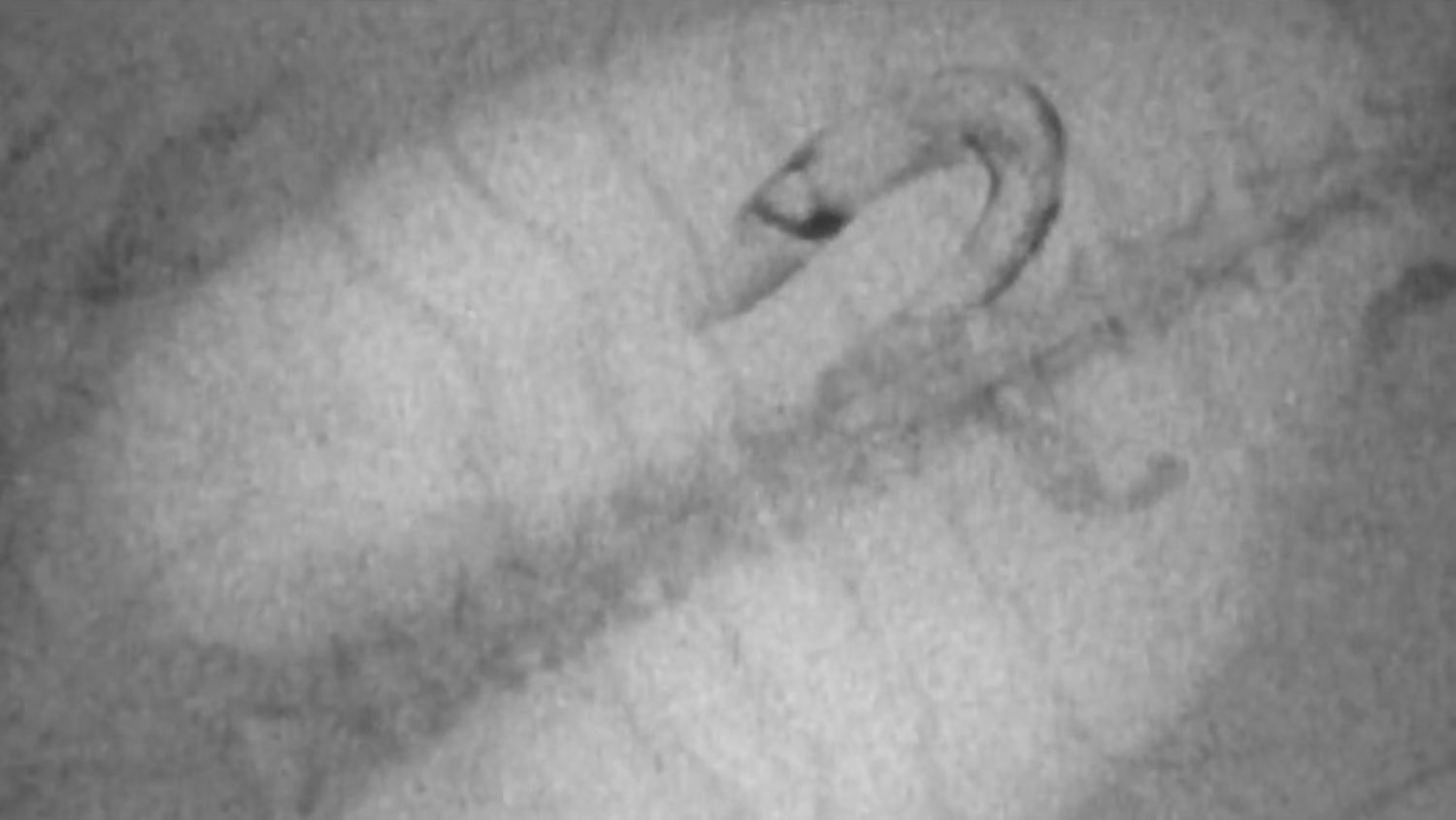 Watch baby Japanese eel escape from stomach of predator in X-ray video ...