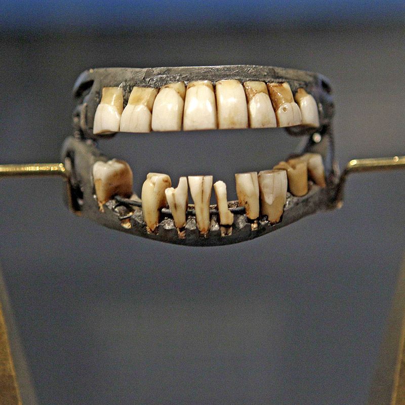 George Washington Gold Teeth