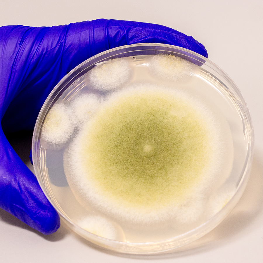 Aspergillus Flavus Cancer