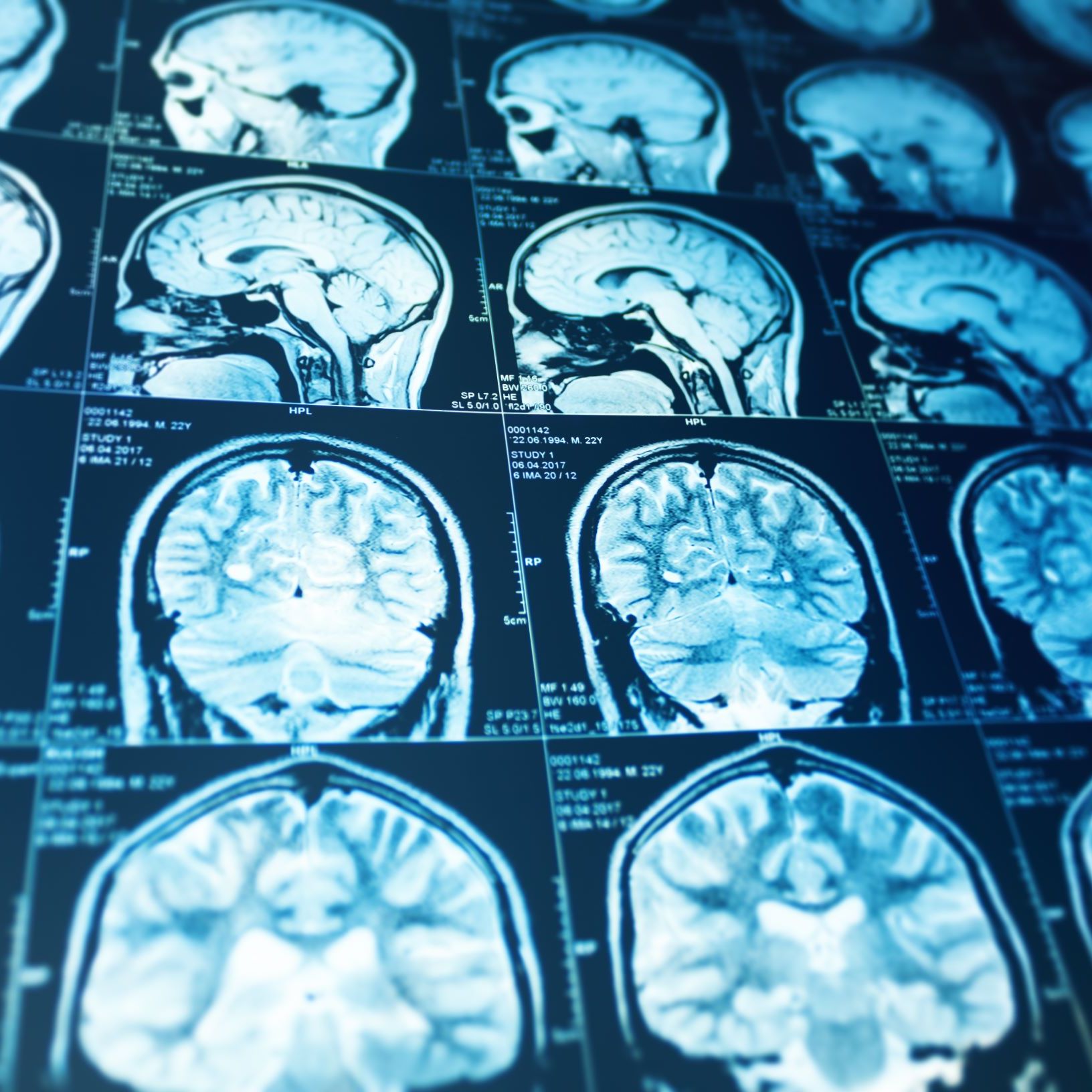 Side Effects Of Watching Too Much Tv On The Brain - Infoupdate.org