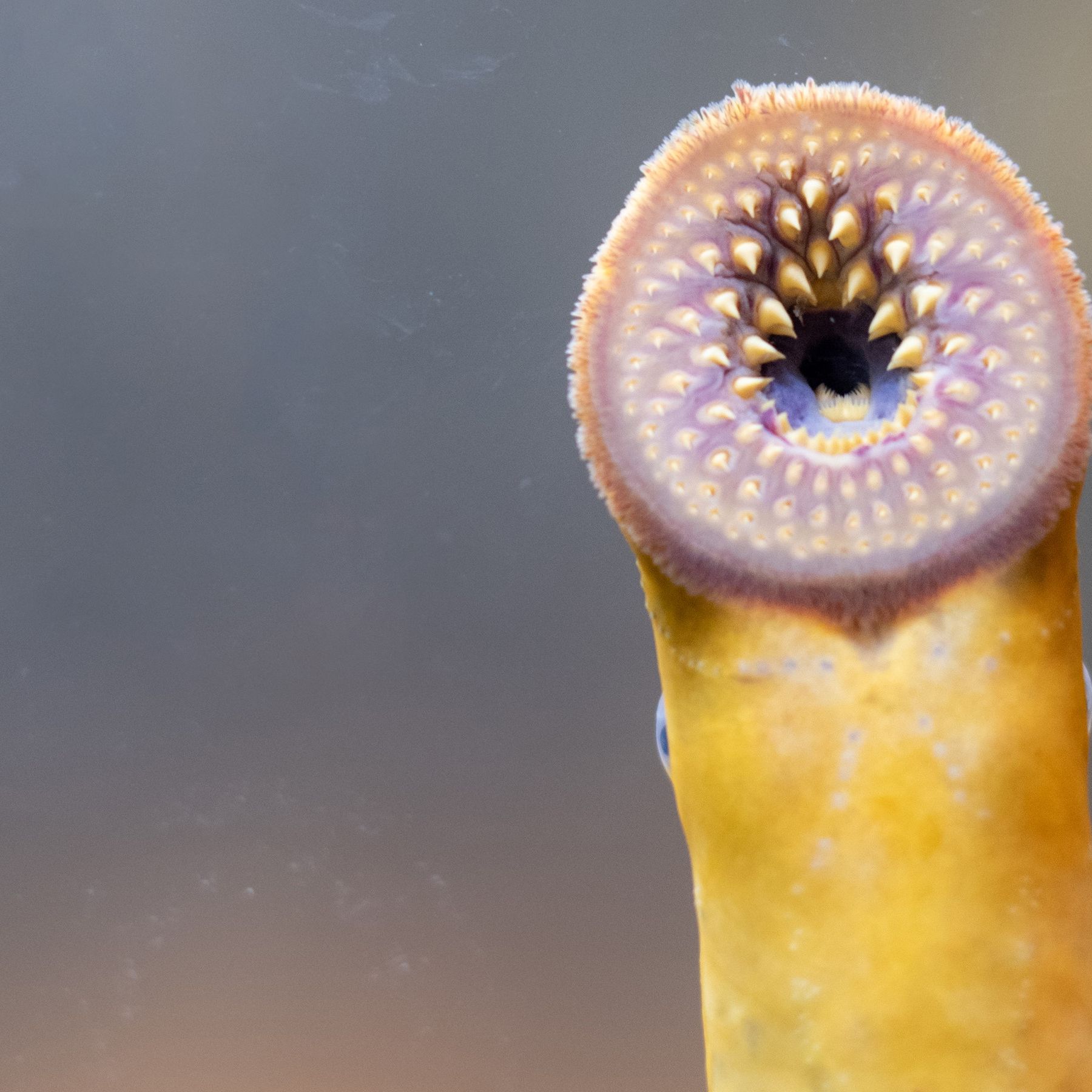 Lamprey Disease In Humans