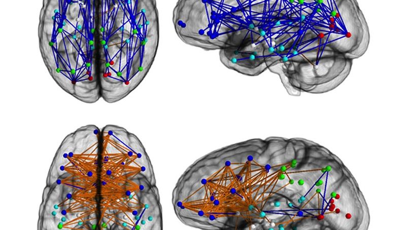 Wired Brain