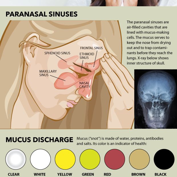 Color Of Nose Discharge Meaning Infoupdate