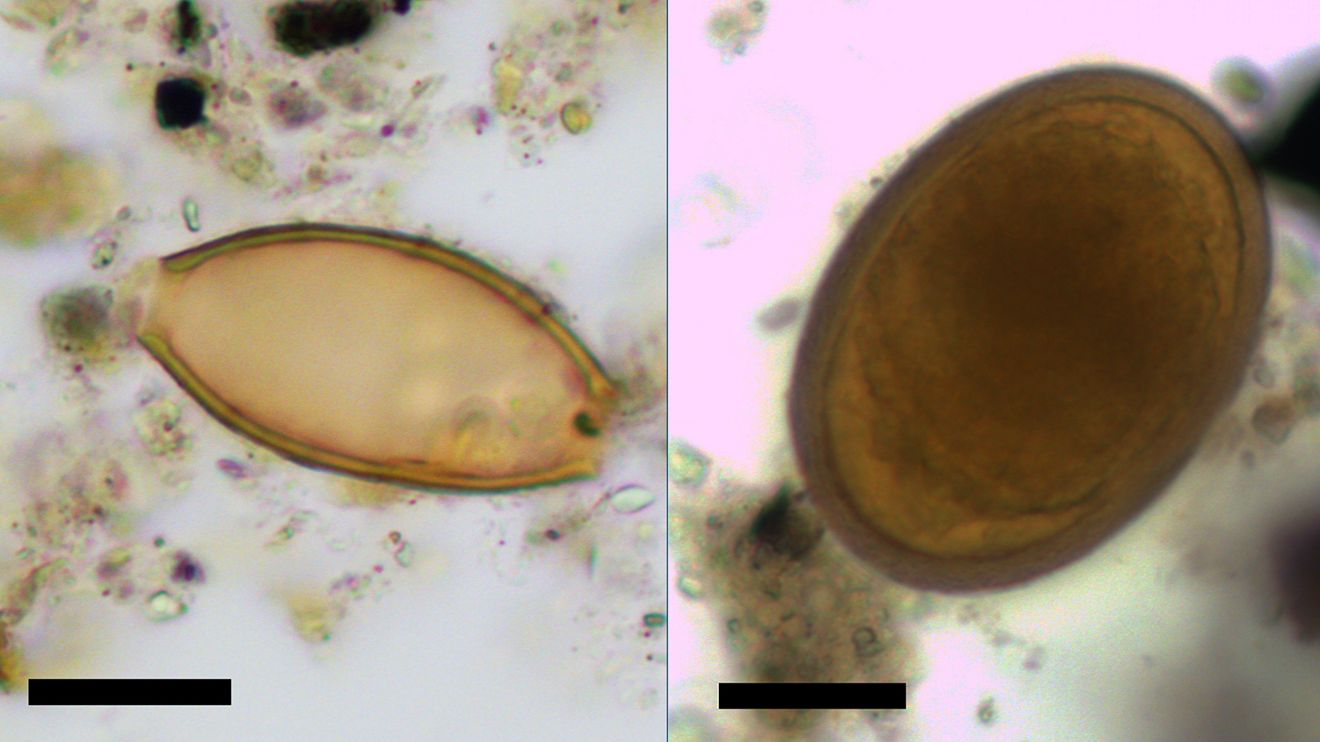 Pinworms In Toddler Poop