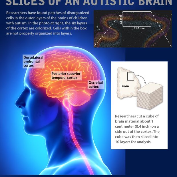Infographic Anatomy Of The Brain Infographics