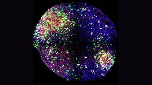 Will brain transplants ever be possible? | Live Science