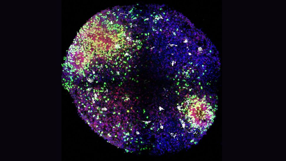 'Minibrains' reveal secrets of how key brain cells form in the womb ...
