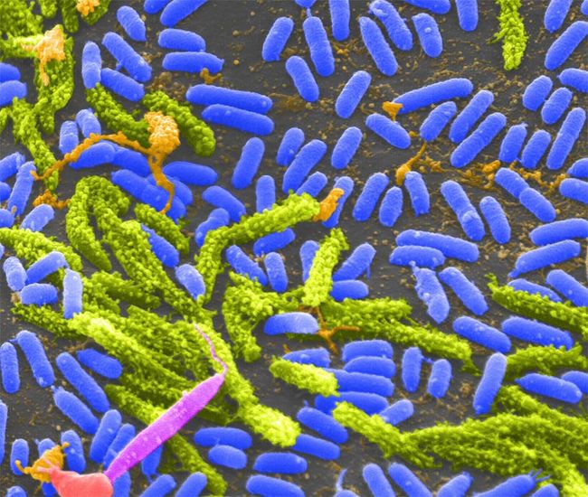 The Quake That Brought Back Cholera | Live Science