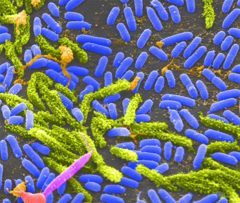 The Quake That Brought Back Cholera | Live Science