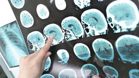 First-ever scan of a dying human brain reveals life may actually 'flash ...