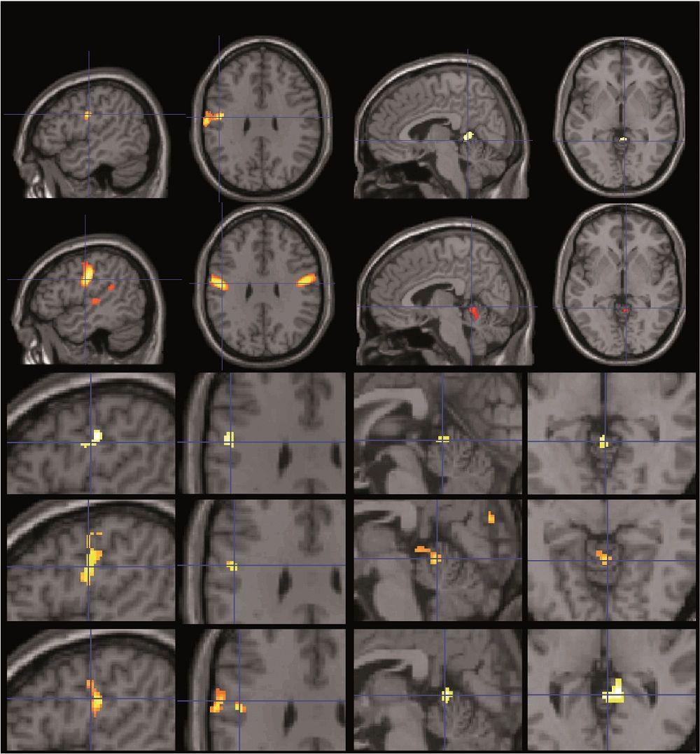 Teens' IQs Can Fluctuate, Study Suggests | Live Science