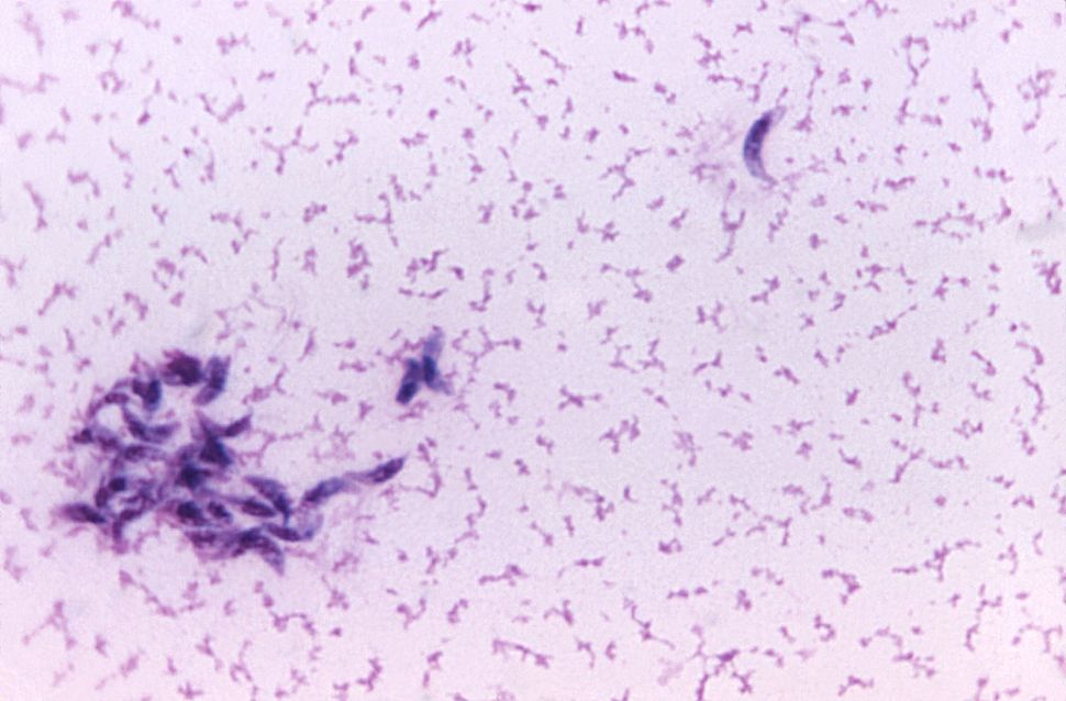 Parasite found in cat poop linked to higher brain cancer risk in humans ...