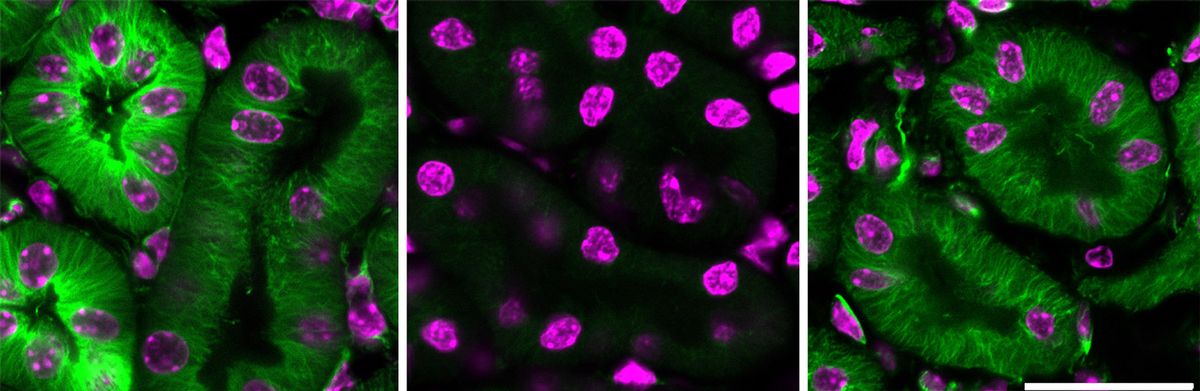 How Adorable Hibernating Squirrels Could Help Scientists Preserve Human ...