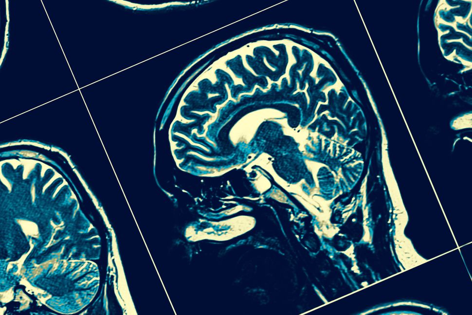 Your Brain Contains Magnetic Particles, and Scientists Want to Know Why ...