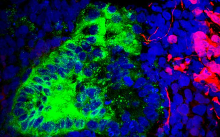 Lab-Grown Mini Kidneys 'Go Rogue,' Sprout Brain and Muscle Cells | Live ...