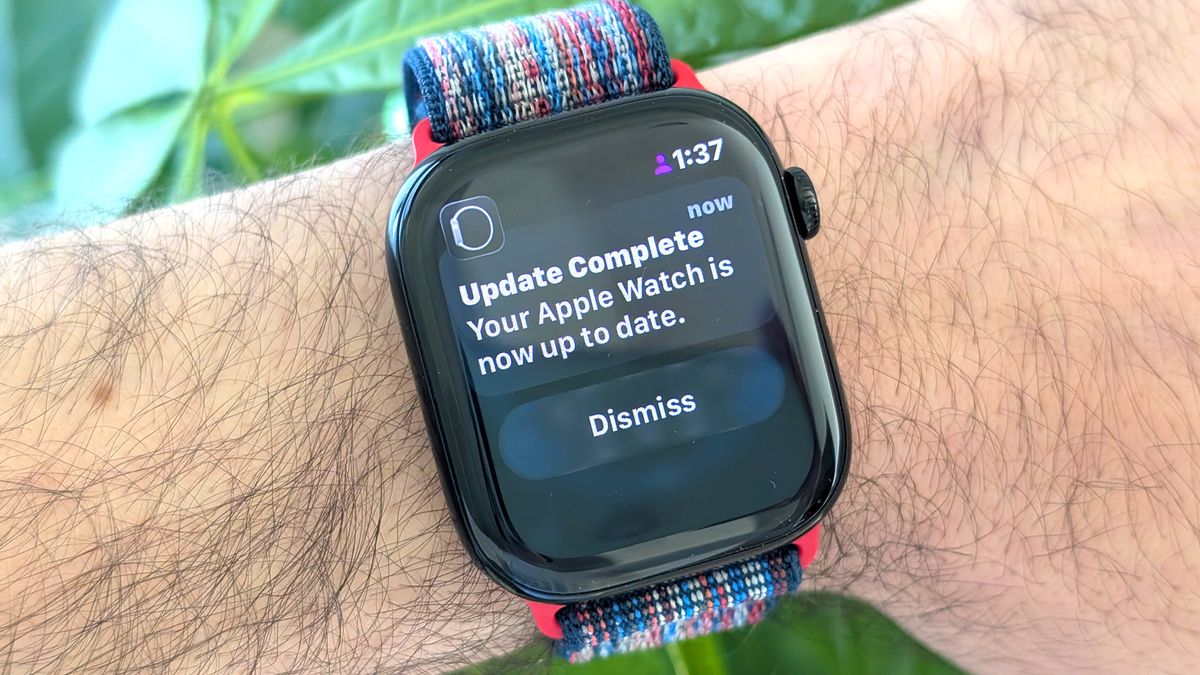 How to download and install watchOS 26 | Tom's Guide