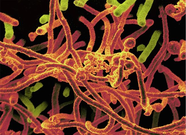28 Devastating Infectious Diseases | Live Science