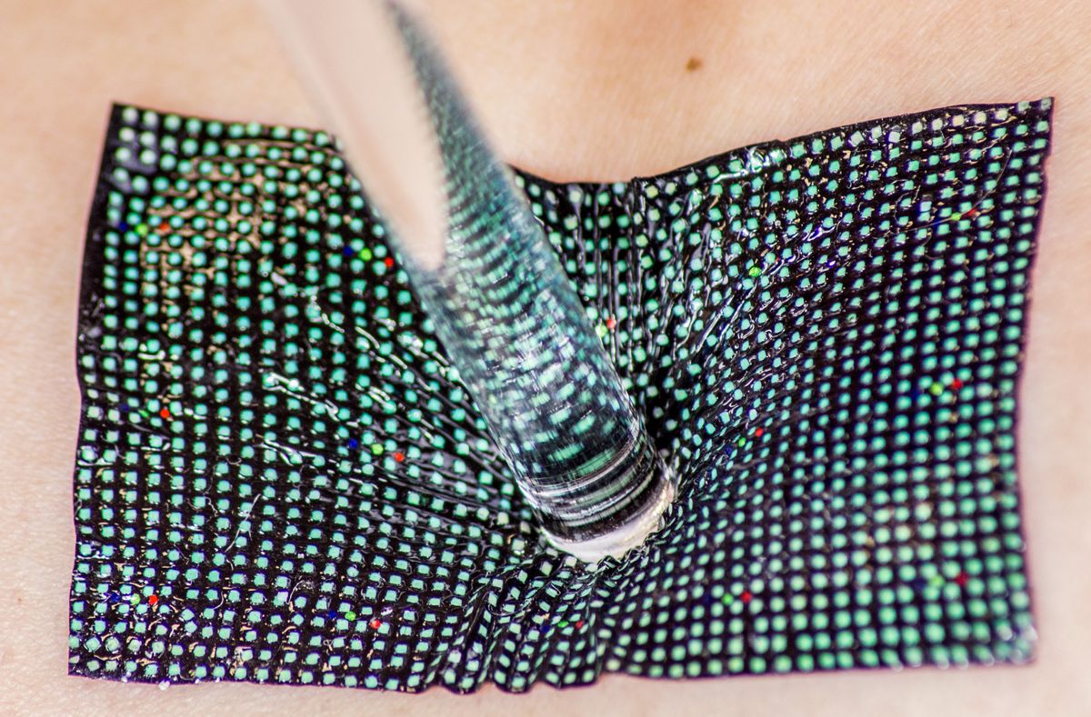 'Second-Skin' Sensor Could Track Your Health | Live Science