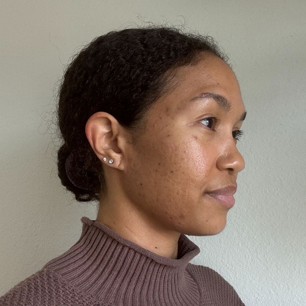 A Beauty Editor Reviews Cellstory Liquid Micro-Needling | Who What Wear