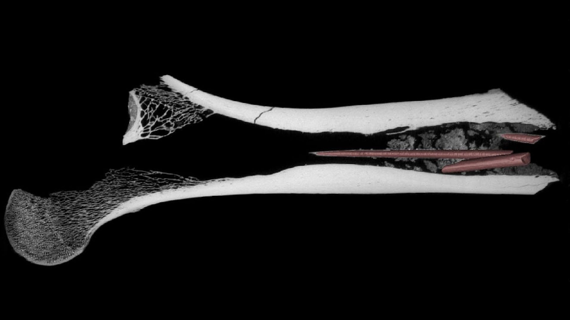 7,000-year-old bone holds 3 arrowheads with mixed poisons — the oldest ...