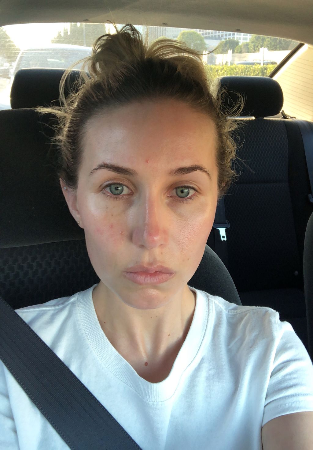 The 19 Best Skincare Products for Redness, Editor-Tested | Who What Wear