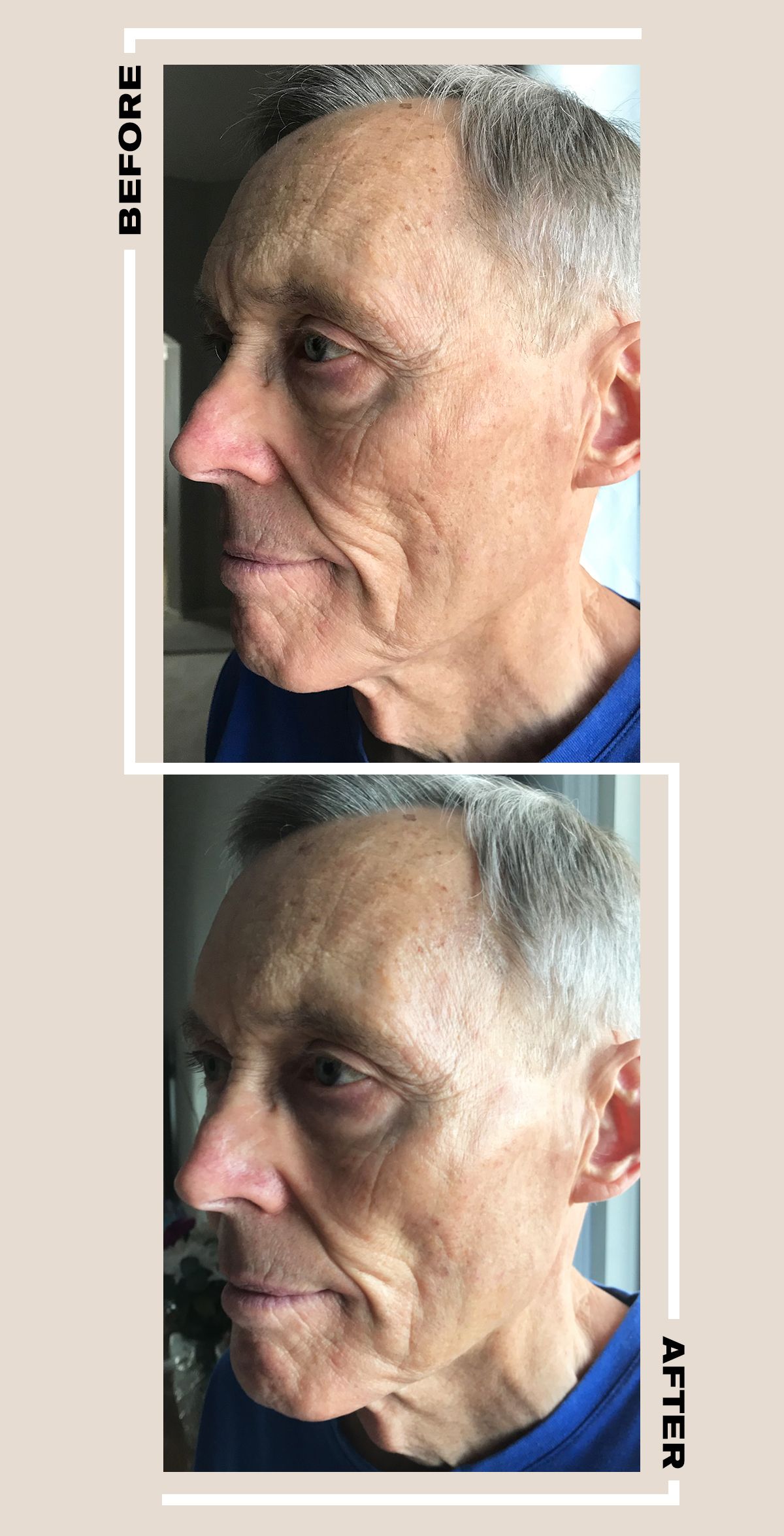 Reviewed: Beboe Therapies High Potency CBD Sheet Masks | Who What Wear