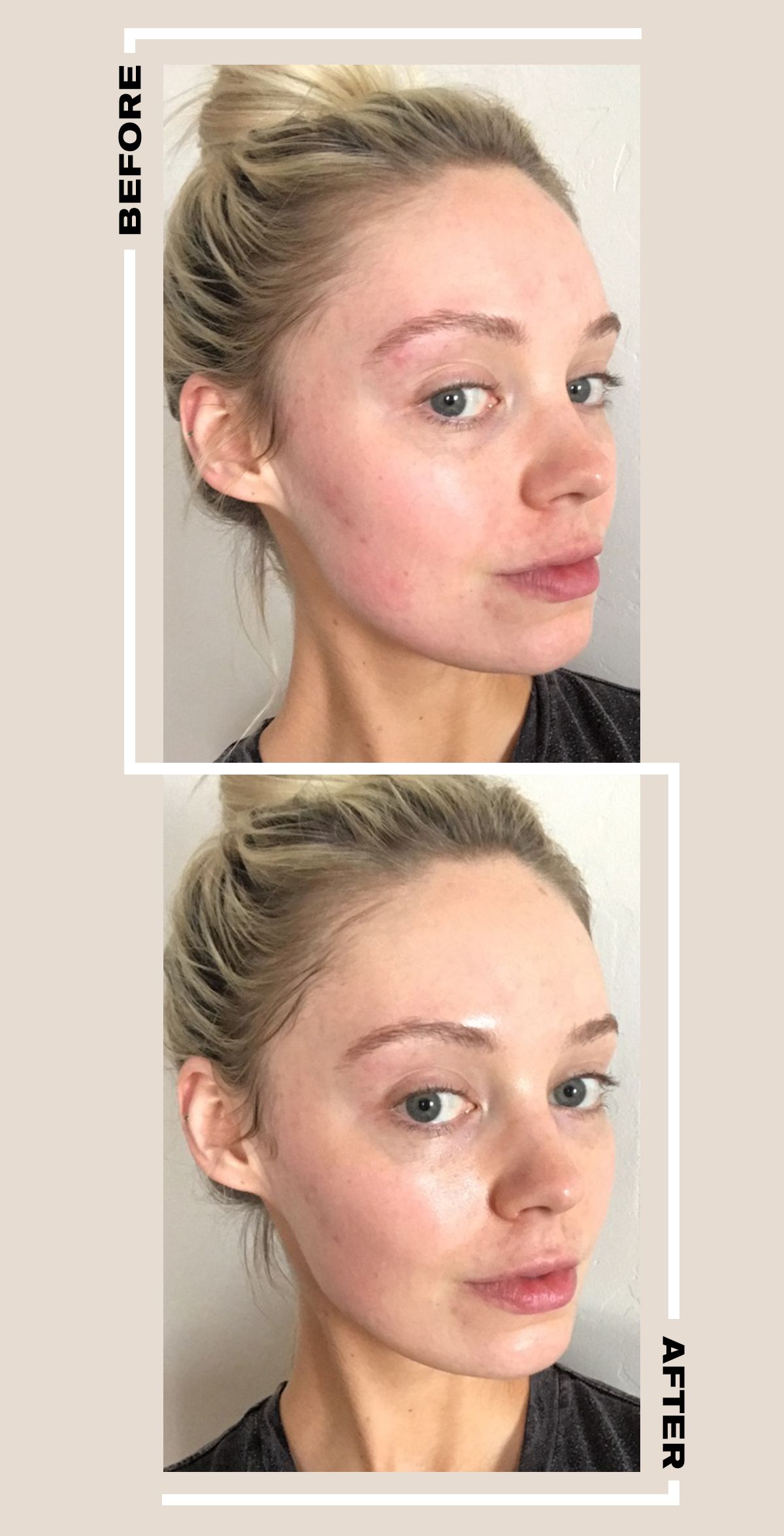 Reviewed: Beboe Therapies High Potency CBD Sheet Masks | Who What Wear