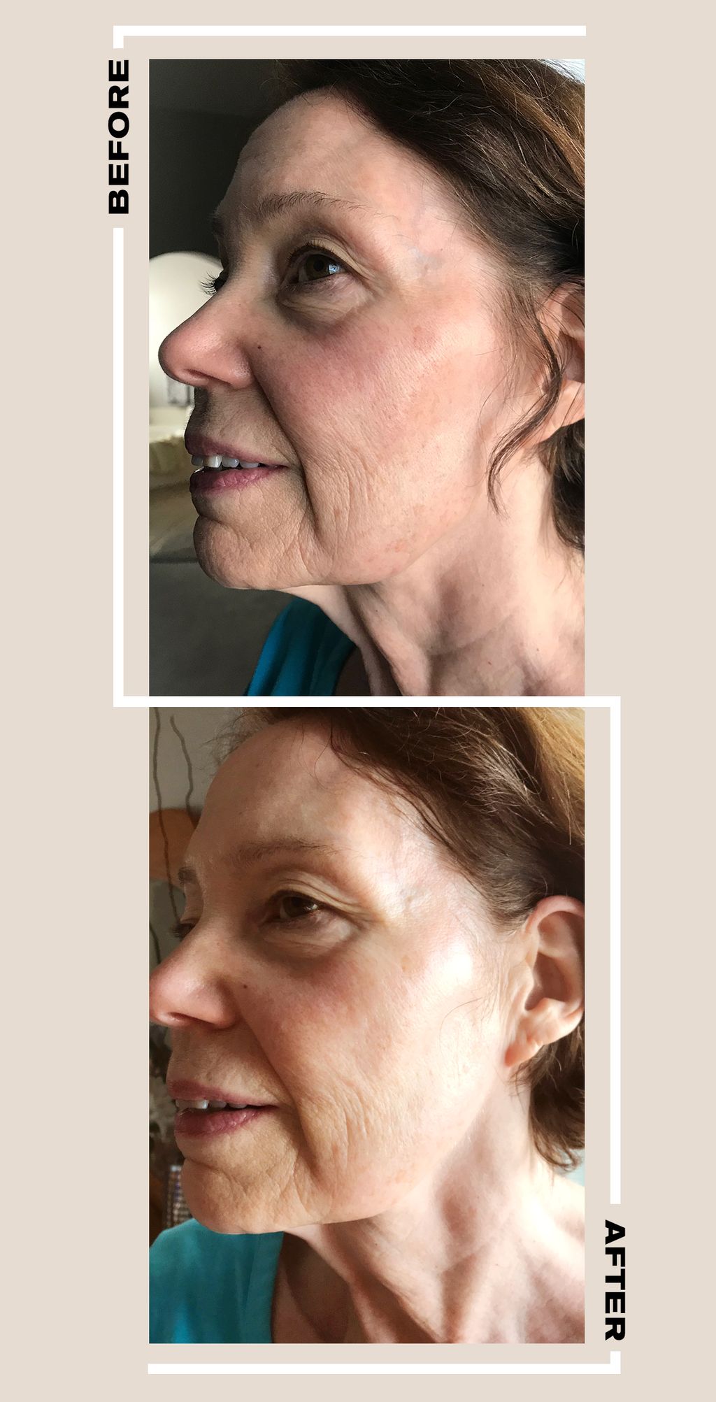 Reviewed: Beboe Therapies High Potency CBD Sheet Masks | Who What Wear