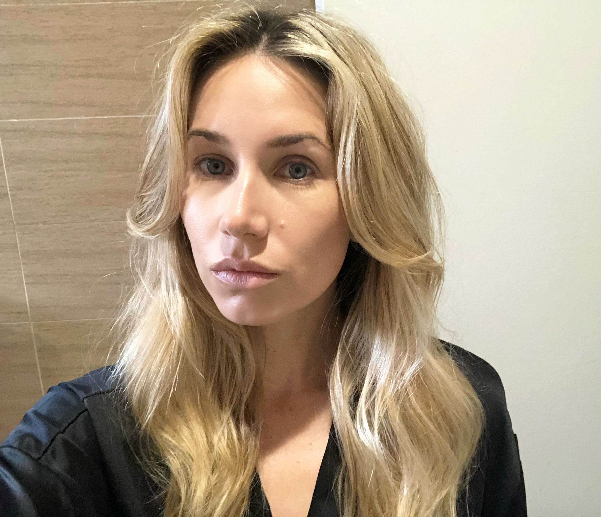 The 9 Best Makeup Products for Redness, Hands Down | Who What Wear