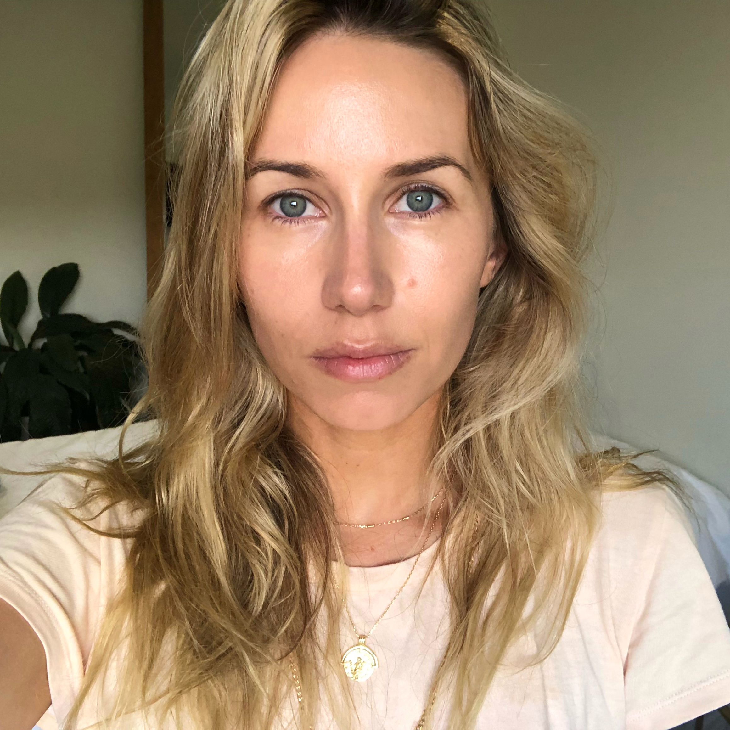 Everything You Need to Know About Micro-Needling | Who What Wear UK