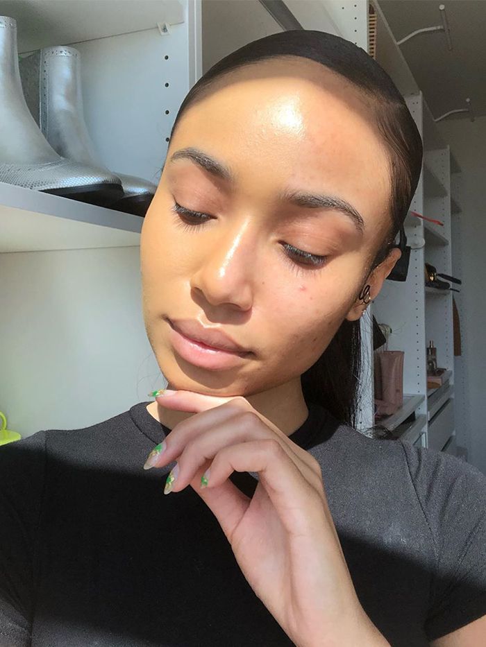 The Main Causes of Spots and How to Deal With Them | Who What Wear