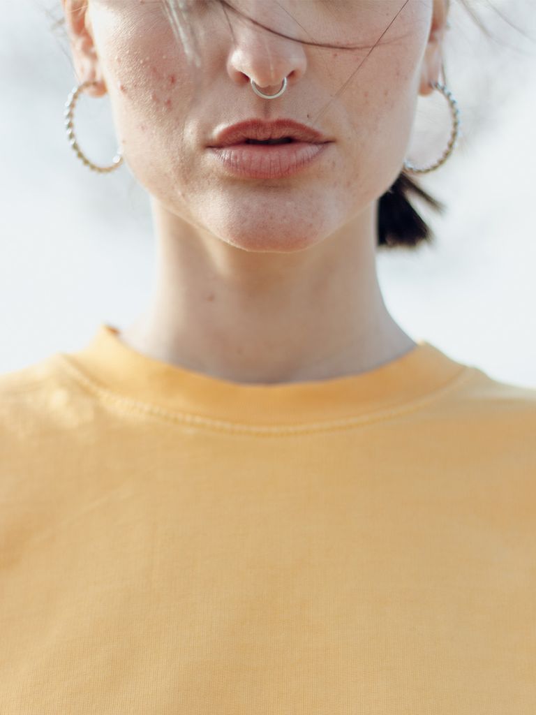 How to Treat Cystic Acne, According to Skin Experts | Who What Wear