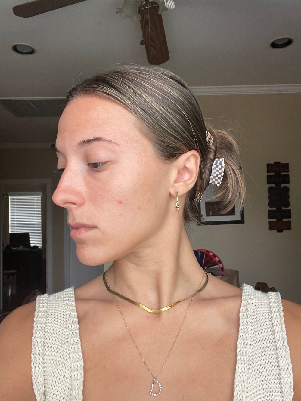 Microneedling For Acne Scars: How It Works and Effectiveness | Who What ...