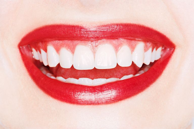 The 13 Best Teeth-Whitening Products Out There | Who What Wear
