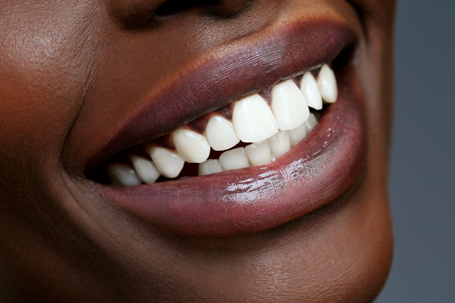 The 13 Best Teeth-Whitening Products Out There | Who What Wear