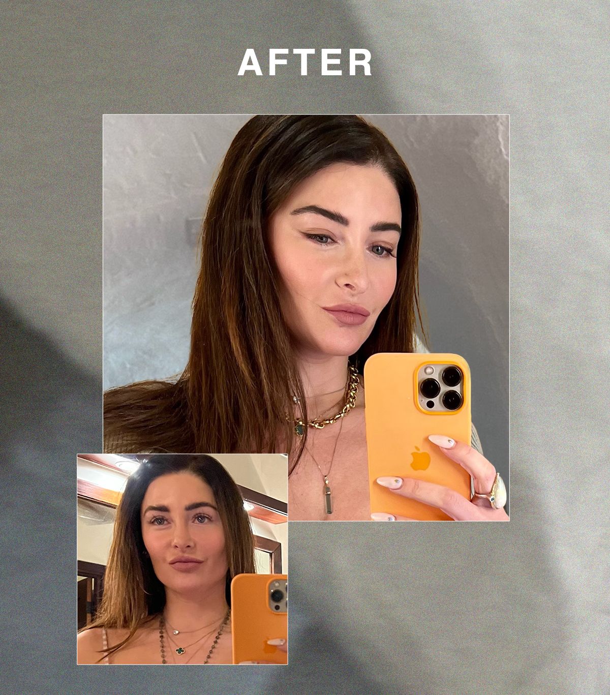 Reviewed: Cosmelan MD Peel for Melasma | Who What Wear