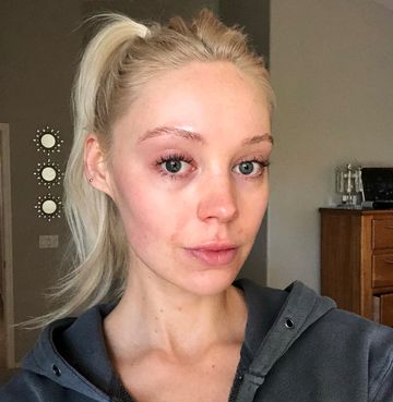 Byoma's $16 Hydrating Serum Transformed My Skin in One Week | Who What Wear