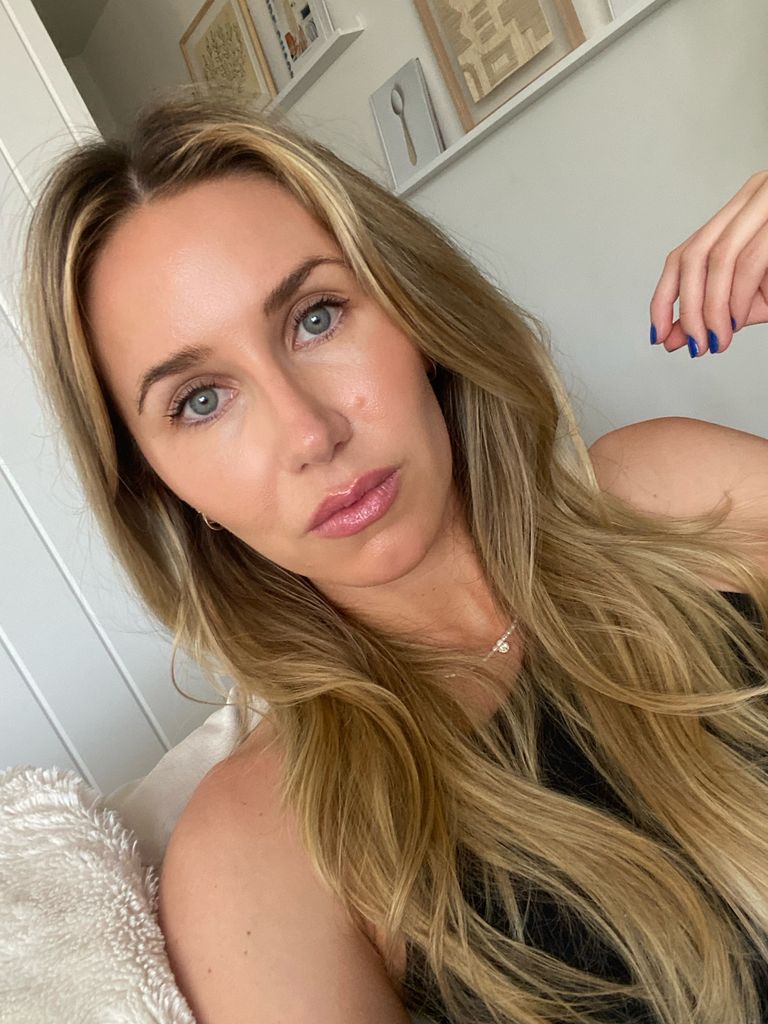 The Best Filler Tips to Know Before Treatment | Who What Wear