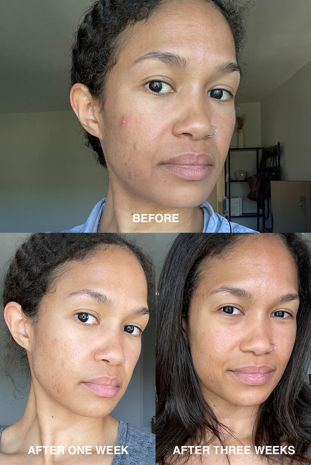 A Beauty Editor Reviews Herbal Face Food's Serum | Who What Wear