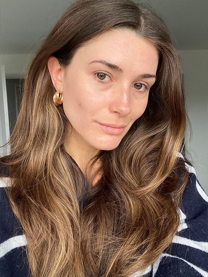 The 16 Best Eczema Creams, as Rated by a Beauty Editor | Who What Wear