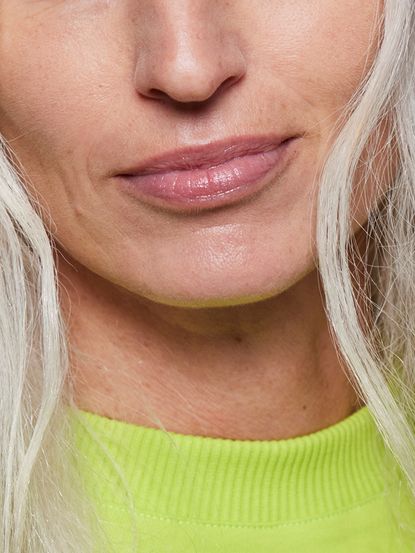 How to Get Rid of Lip Lines, According to Dermatologists | Who What Wear