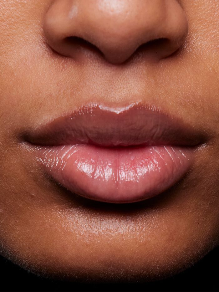 How to Get Rid of Lip Lines, According to Dermatologists | Who What Wear