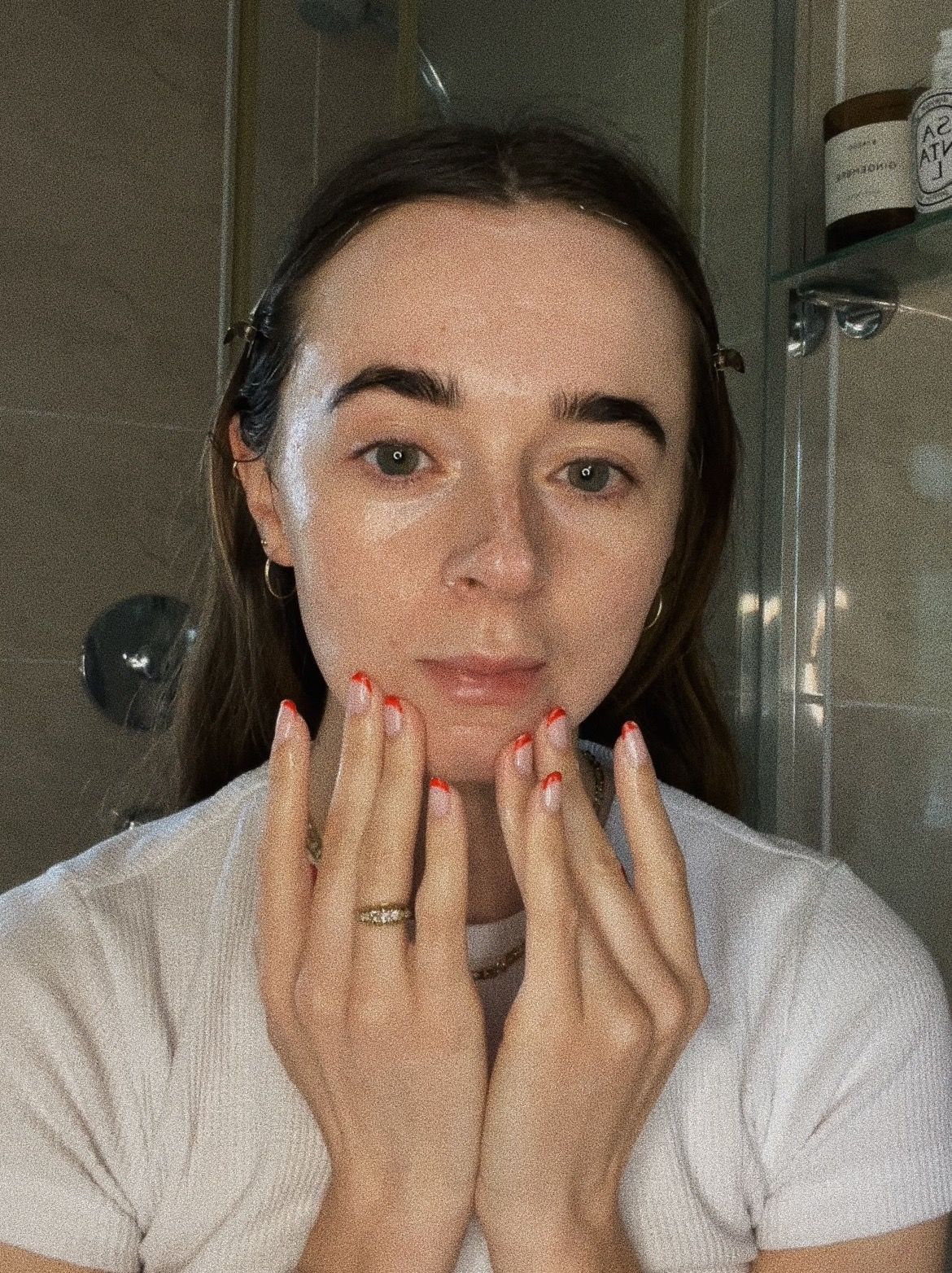 Everything You Need To Know About Short Contact Therapy | Who What Wear UK