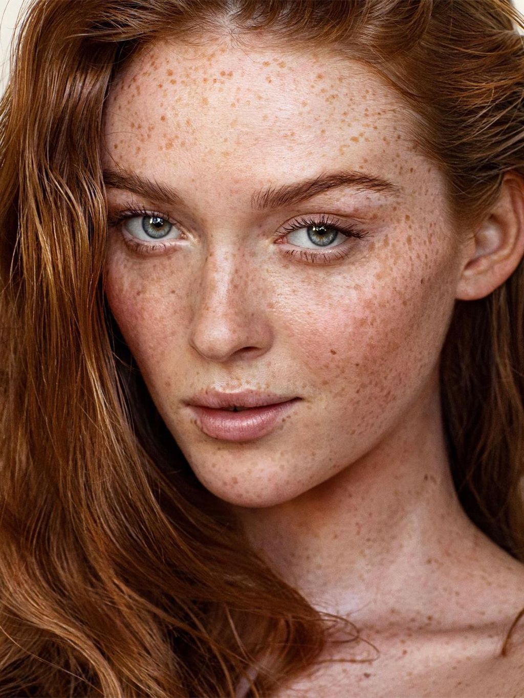 The 9 Best Freckle-Loving Foundations Money Can Buy | Who What Wear