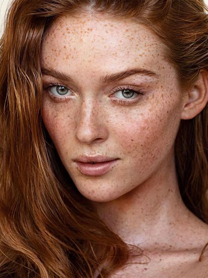 The 9 Best Freckle-Loving Foundations Money Can Buy | Who What Wear