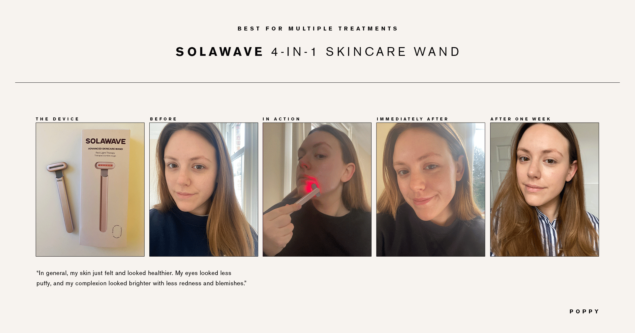 The Best Facial Microcurrent Devices, Tried and Tested | Who What Wear UK