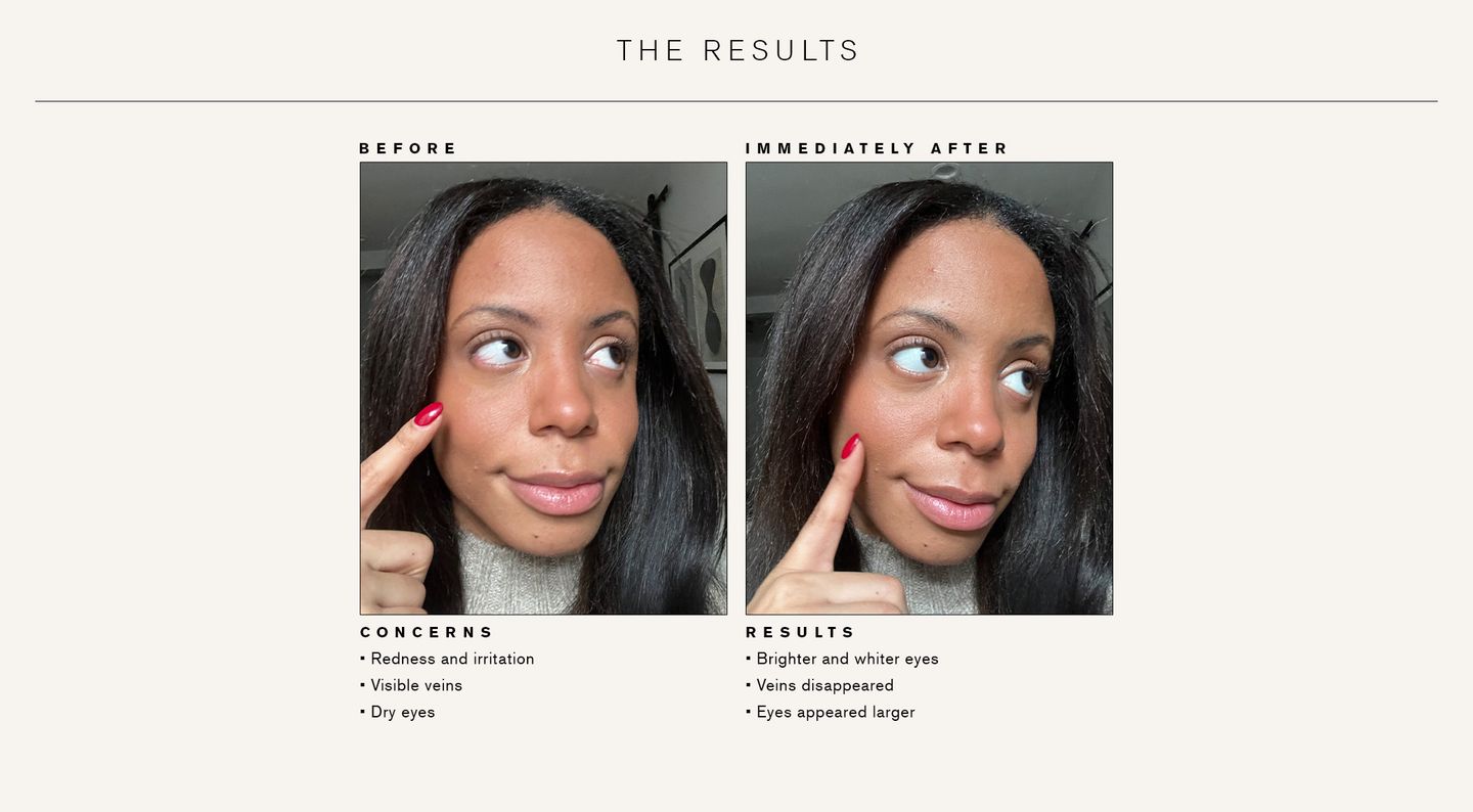 An Honest Review of Lumify Redness Reliever Eye Drops | Who What Wear